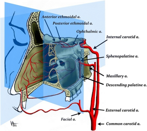 Epistaxis - WikEM