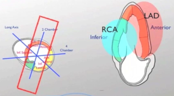 Formal echocardiography - WikEM