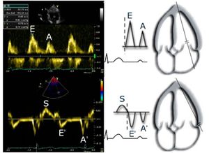 Formal echocardiography - WikEM