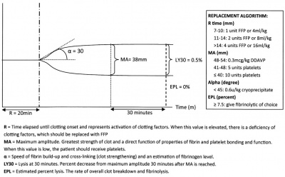 Thromboelastography (TEG) - WikEM