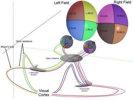Visual field defects - WikEM